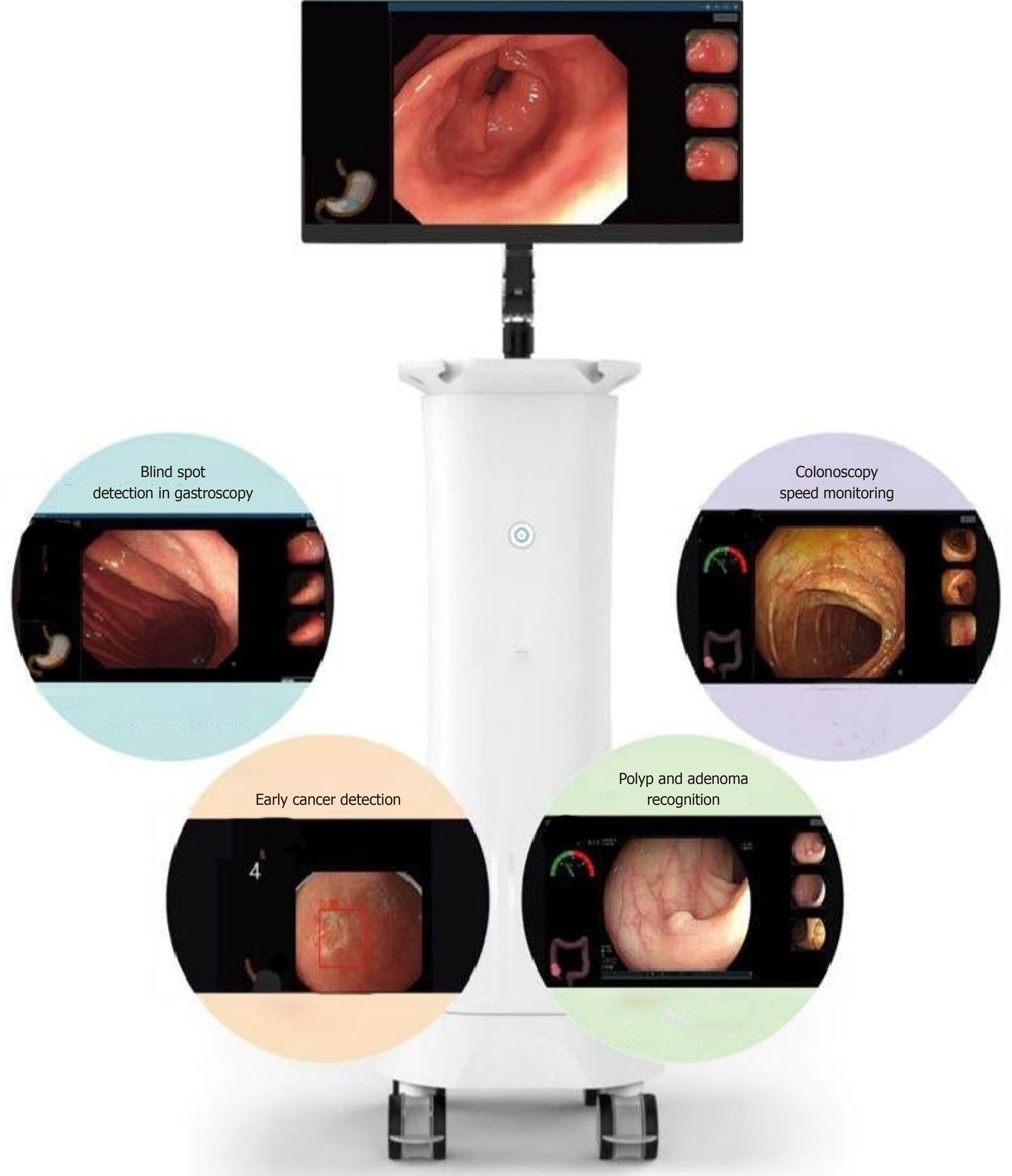 Revolutionizing upper gastrointestinal disease diagnosis: The ...