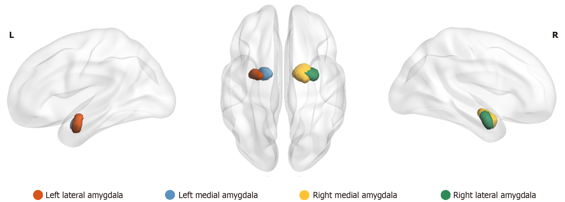 Aberrant resting-state functional connectivity in amygdala subregions ...
