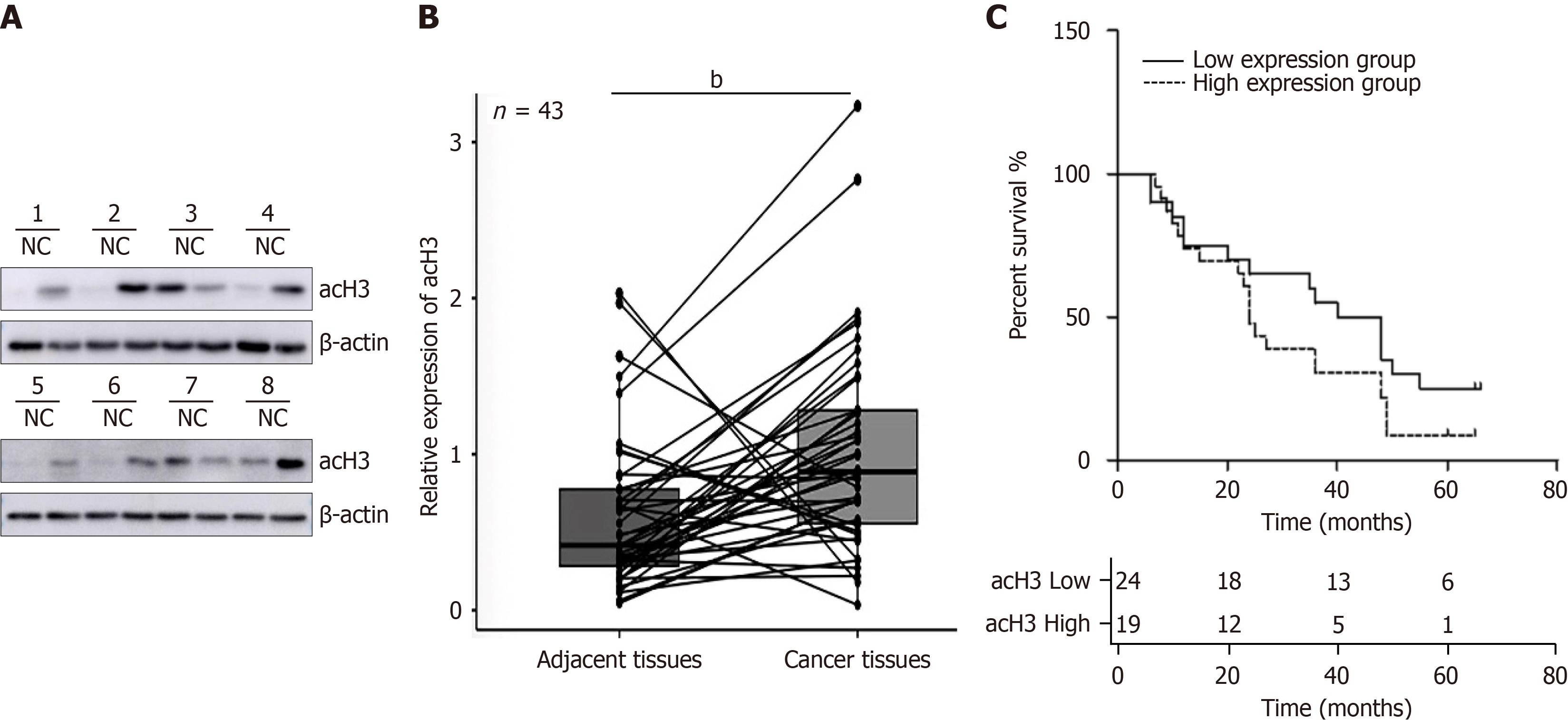 Trichostatin A augments cell migration and epithelial-mesenchymal ...