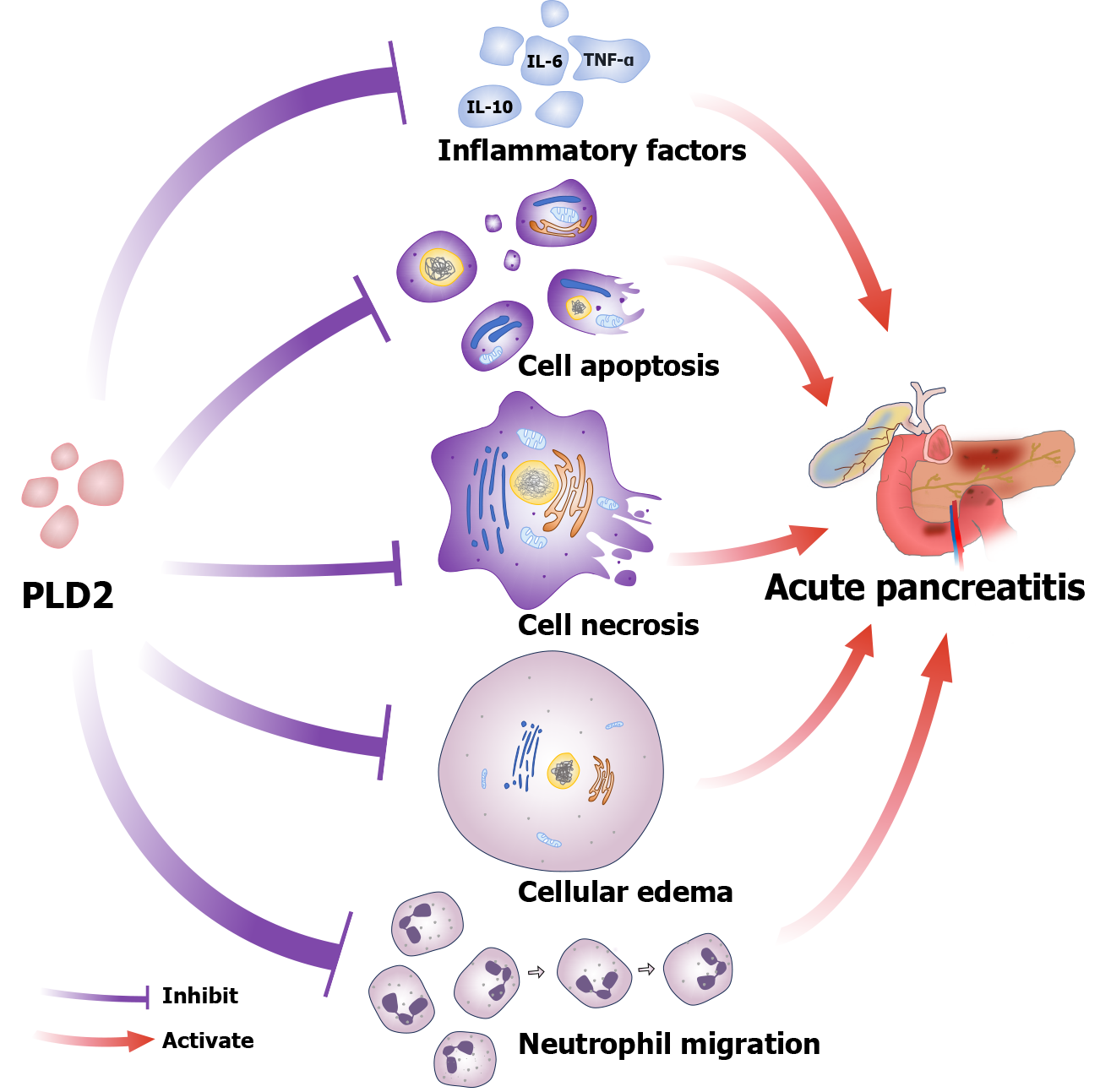 Phospholipase D2: A biomarker for stratifying disease severity in acute ...