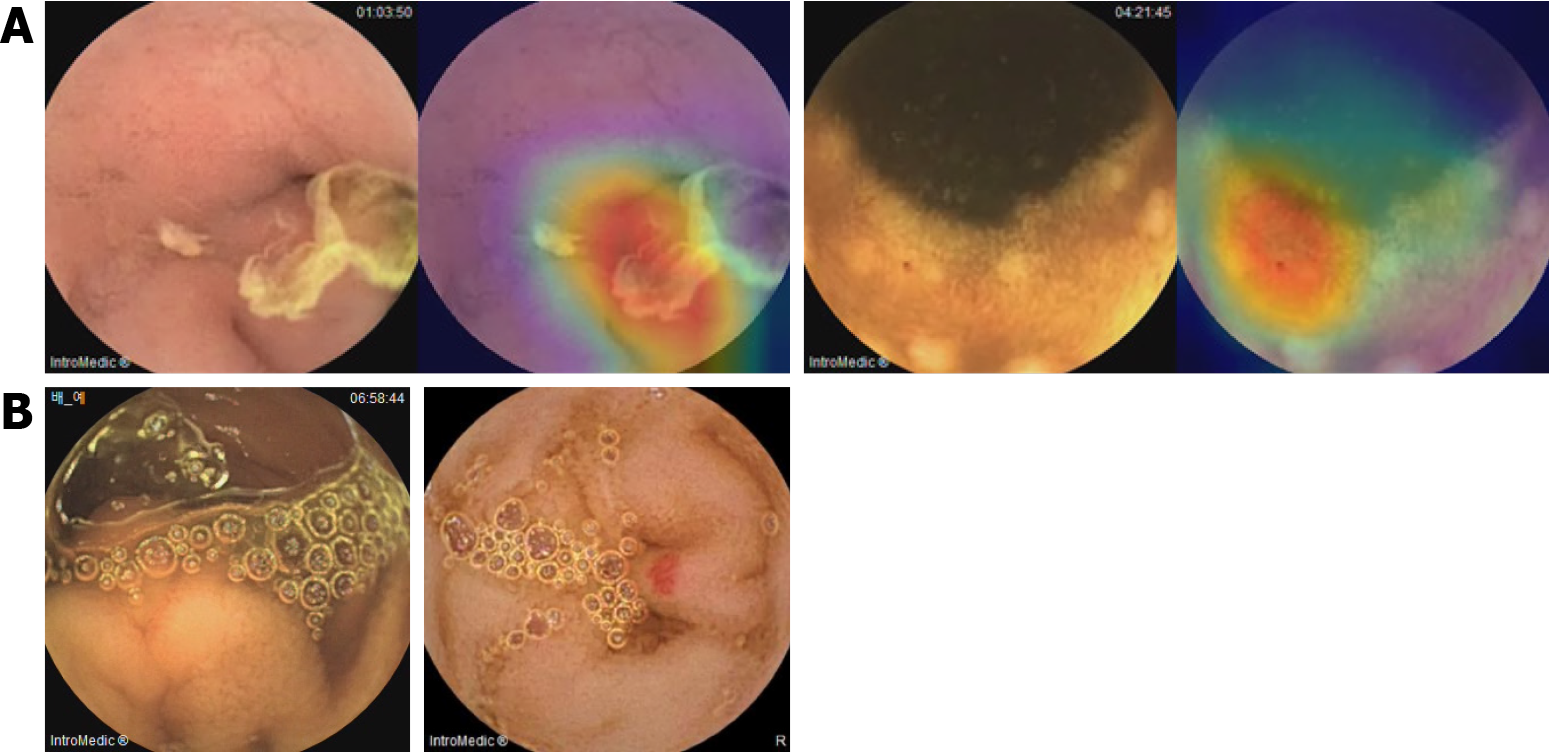 Deep learning-based localization and lesion detection in capsule ...