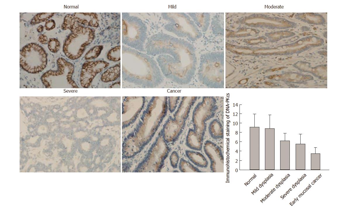 Aberrant DNA-PKcs and ERGIC1 expression may be involved in initiation ...