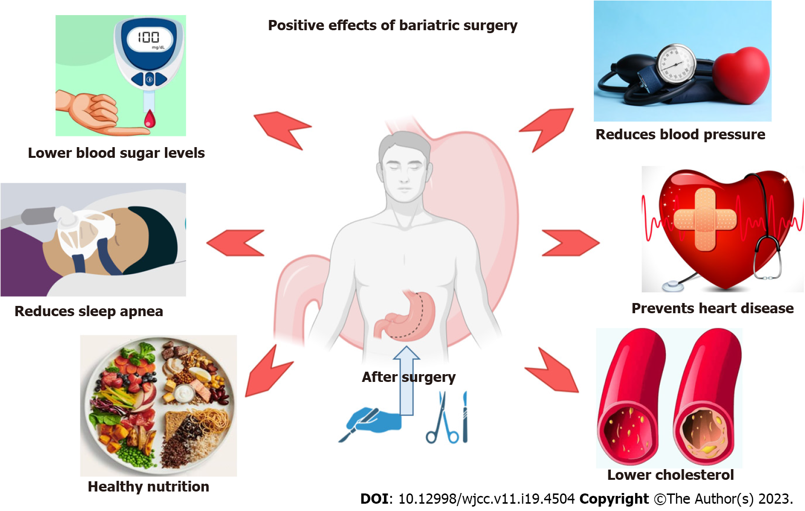 Long term Effectiveness Outcomes And Complications Of Bariatric Surgery