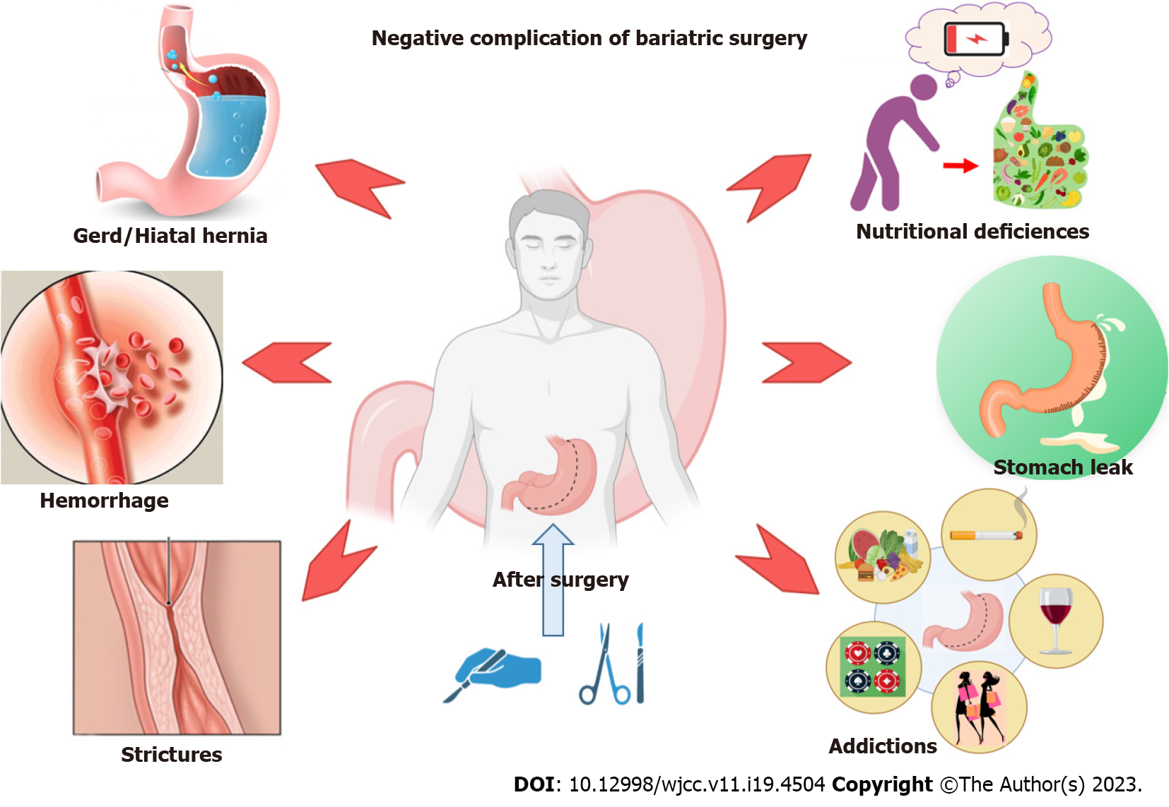 Long term Effectiveness Outcomes And Complications Of Bariatric Surgery