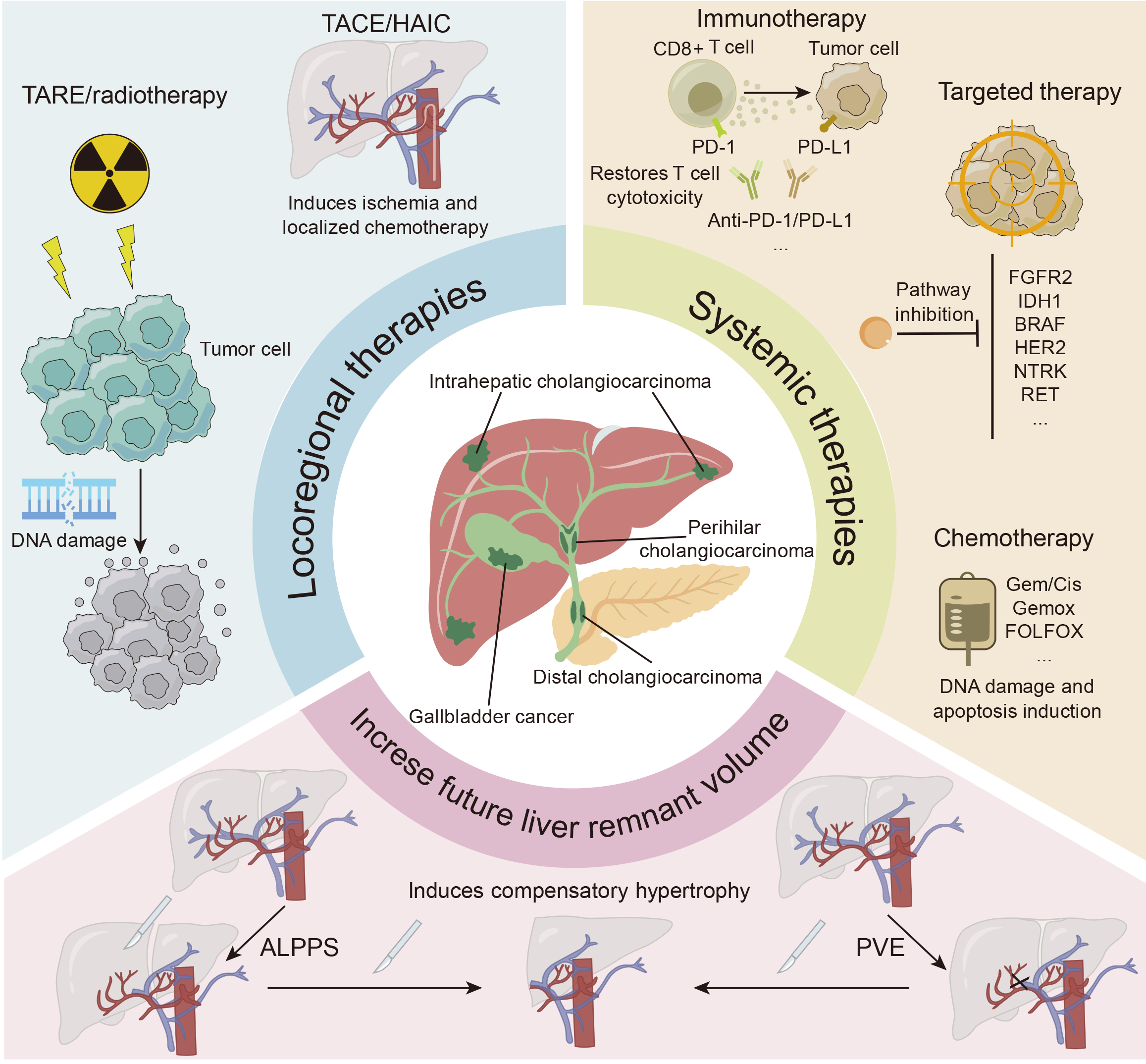 Conversion treatment for advanced intrahepatic cholangiocarcinoma: Opportunities and challenges